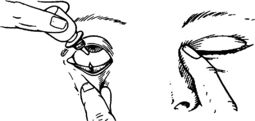 8 Tips On How To Use Pi Yen Chin Opthalmic Eye Drops - East Meets West ...